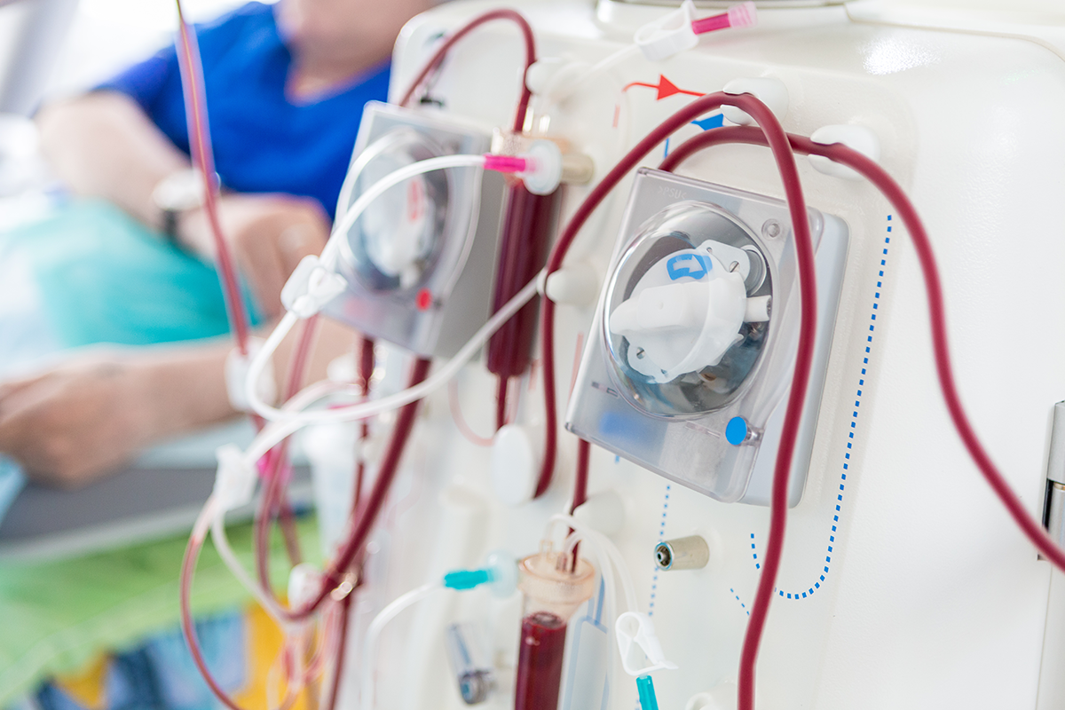 Are You On Dialysis South Carolina Clinical Research